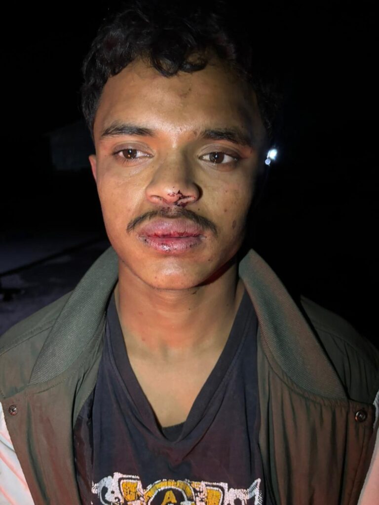 Manipur: Meitei Armed Group Allegedly Assaults Muslim Boy, Forces Him to Eat Pork Over ...